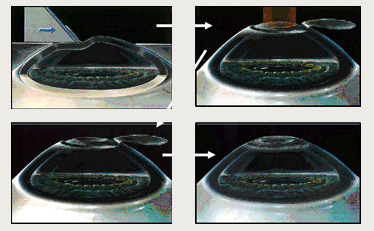 Epi LASIK | Epikeratome Laser Assisted Keratomileusis