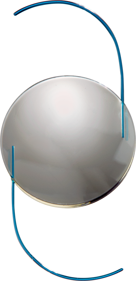 Light Adjustable Lens for Cataract Surgery in Indianapolis | Price ...